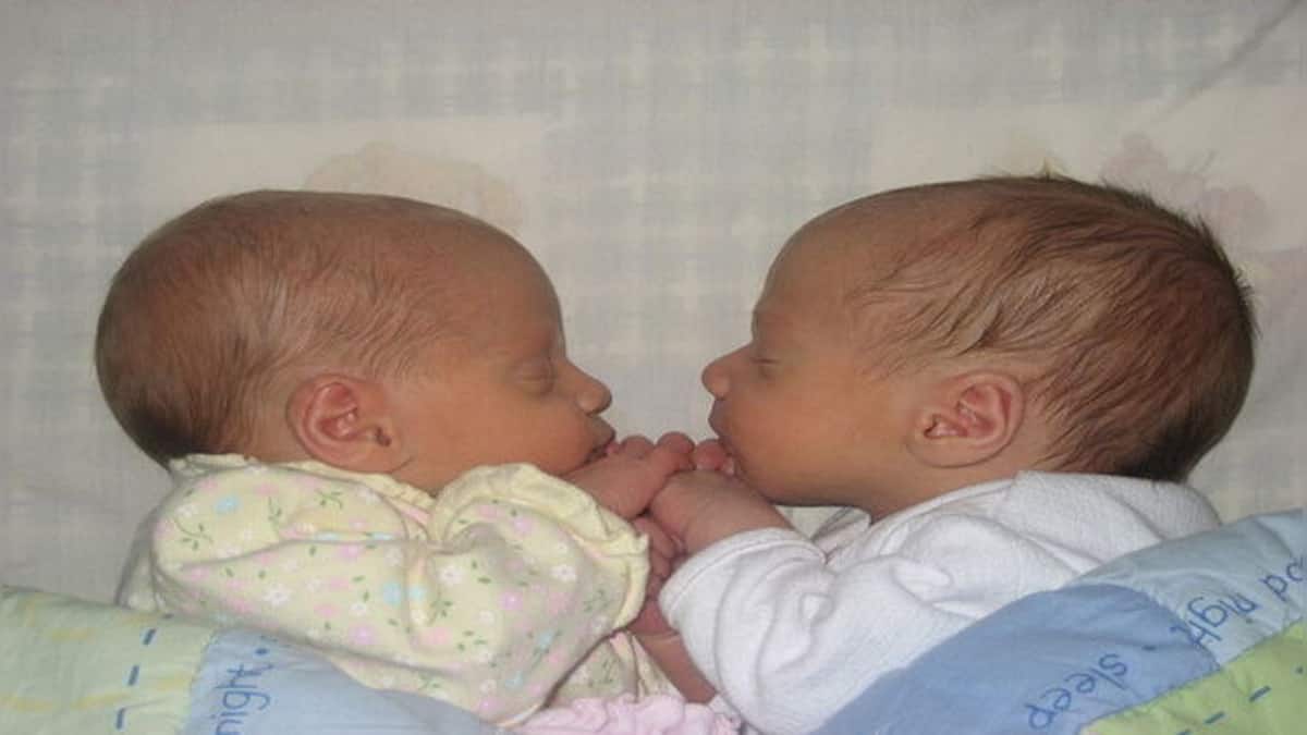 Brazilian woman gives birth to twins with different biological fathers ...