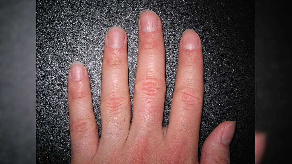 Love gorgeous nails? Tips and ways for healthy and pretty nails – Firstpost