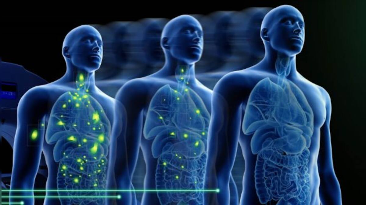 India recorded 14.1 lakh new cancer cases, 9.1 lakh deaths: WHO – Firstpost