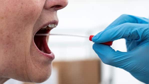 What are ‘obelisks’, the new virus-like entity discovered inside the ...