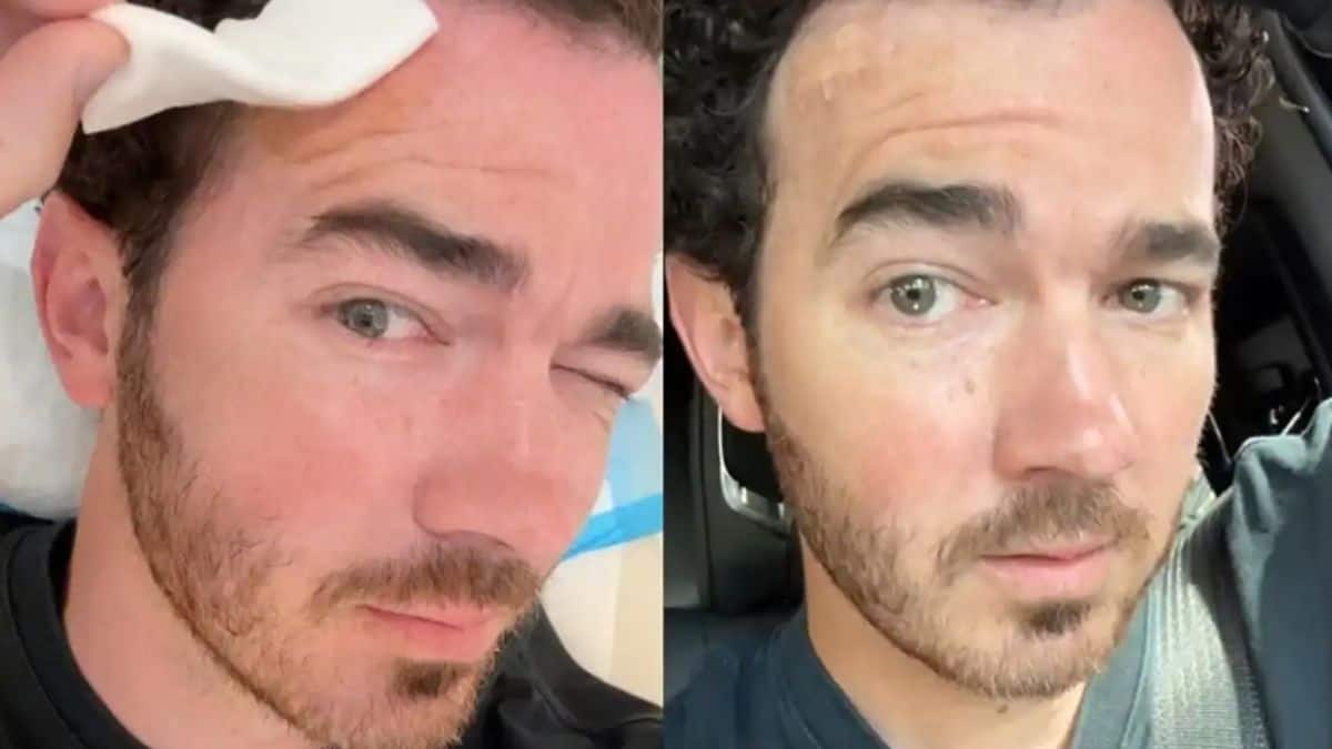 WATCH: Nick Jonas' brother Kevin Jonas diagnosed with skin cancer, says ...