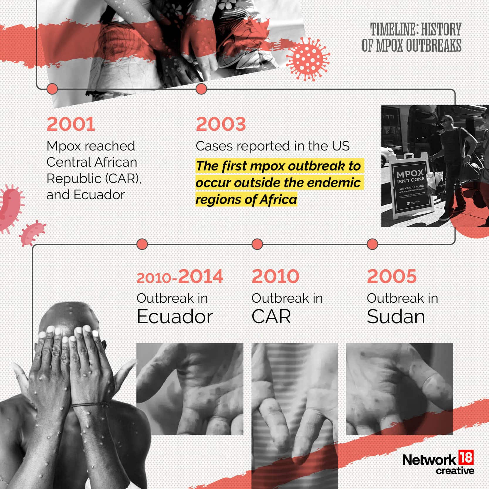 In Graphics | Can mpox spark a COVID-like outbreak? – Firstpost