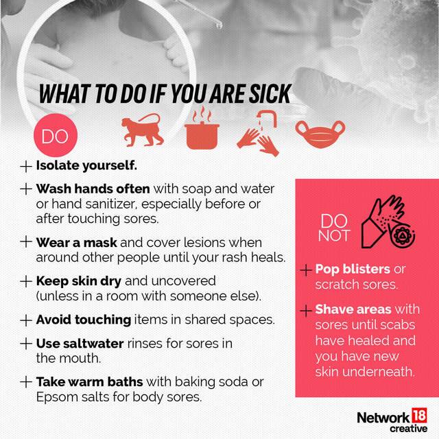 In Graphics | A simple guide to understanding mpox – Firstpost