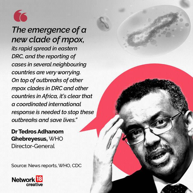 In Graphics | A simple guide to understanding mpox – Firstpost