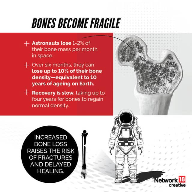 In Graphics | How does the human body change in space? – Firstpost