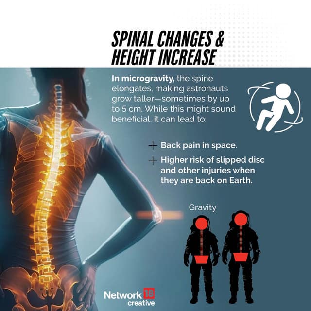 In Graphics | How does the human body change in space? – Firstpost