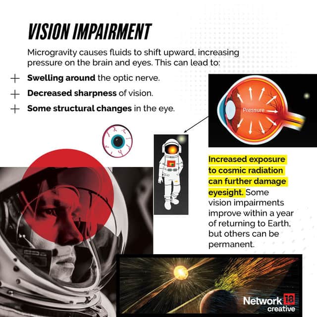 In Graphics | How does the human body change in space? – Firstpost