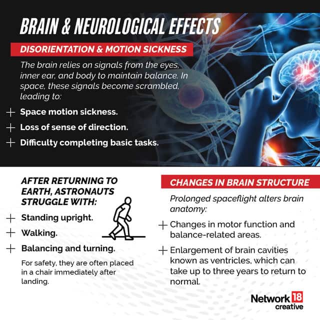 In Graphics | How does the human body change in space? – Firstpost