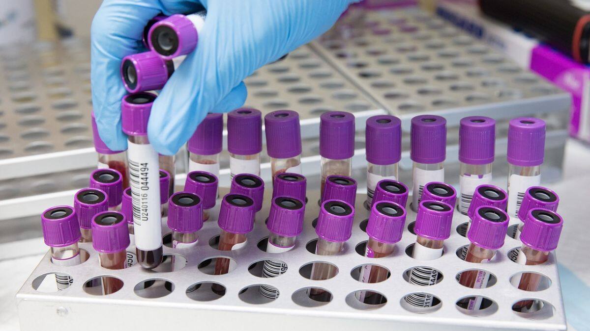 How new blood test could reveal cancer long before symptoms appear ...