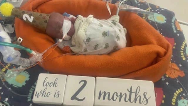 Nash Keen turns 1. Meet Guinness World Record holder of world's most ...