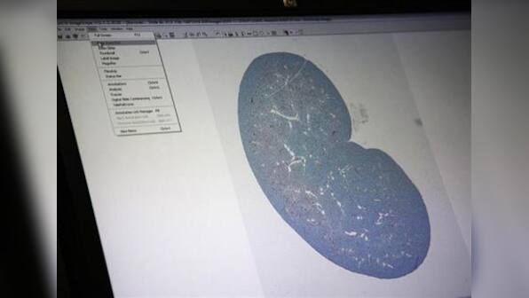 Lab-made rat kidneys raise hopes for dialysis patients – Firstpost