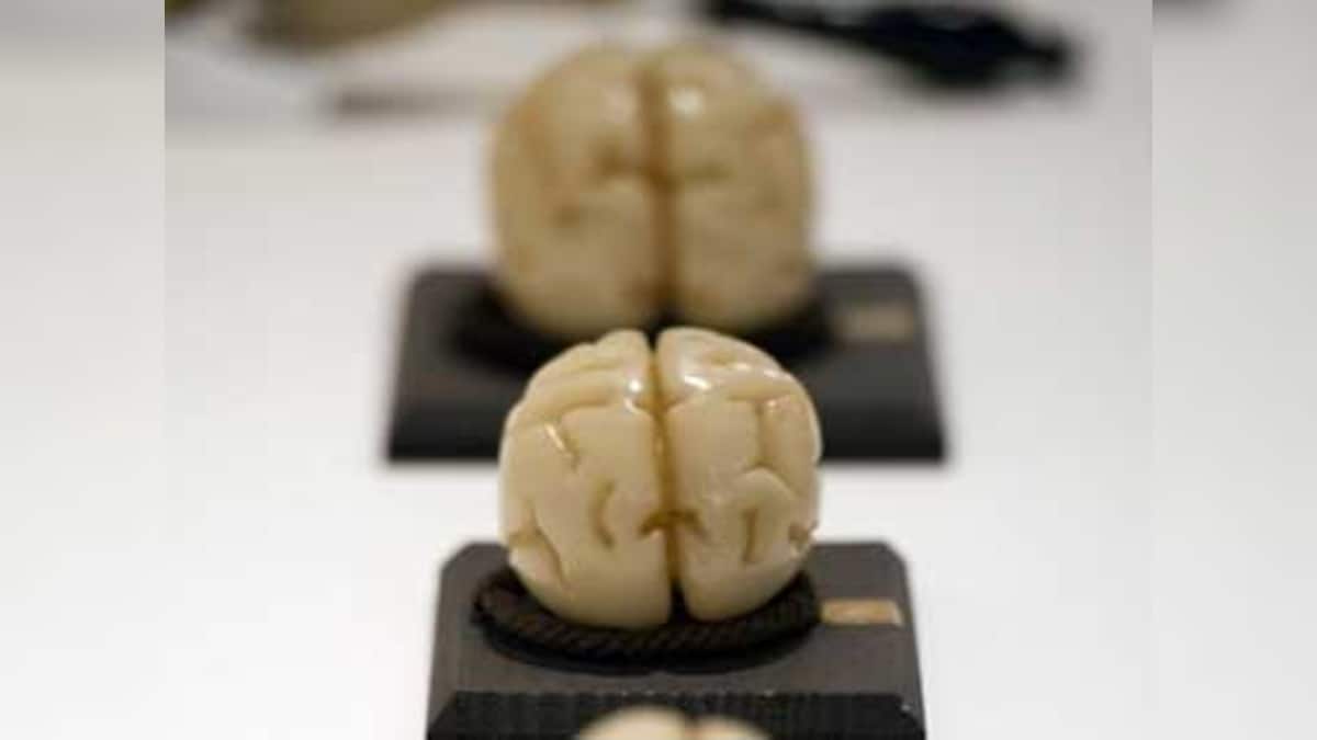 Scientists in Austria grow 'mini human brains' from stem cells – Firstpost
