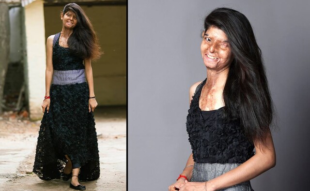 You're beautiful: A truly inspiring photo-shoot of acid attack victims ...