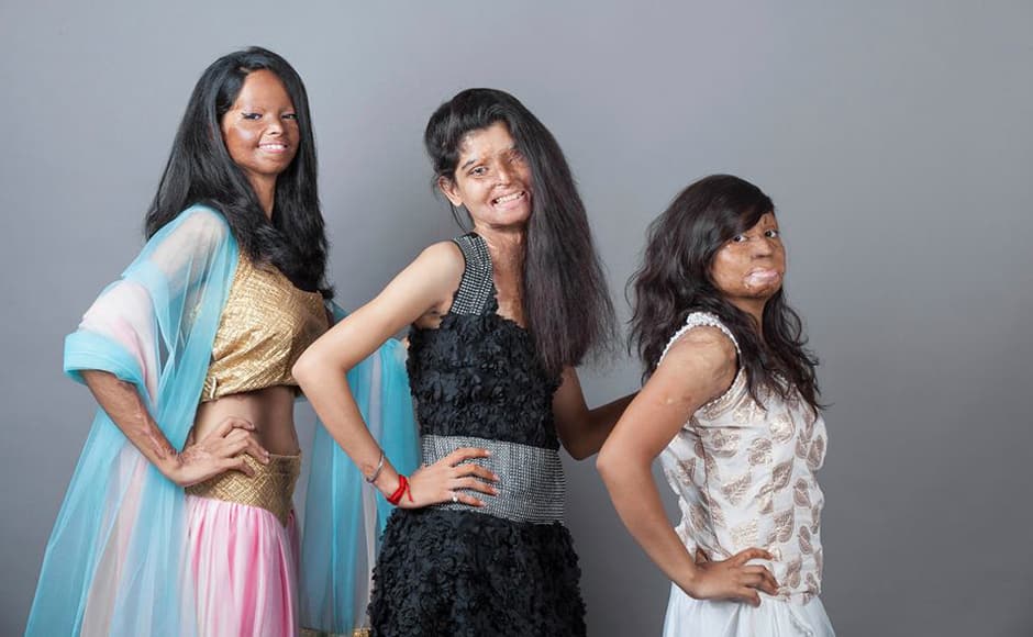 You're beautiful: A truly inspiring photo-shoot of acid attack victims ...
