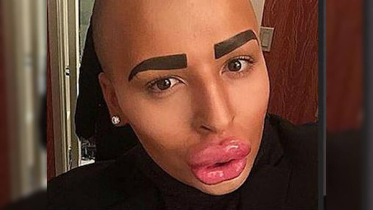 Man shells out $150,000 on plastic surgery to look like Kim Kardashian ...