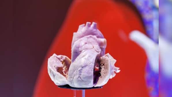 Scientists find key gene mutations behind inherited heart disease ...