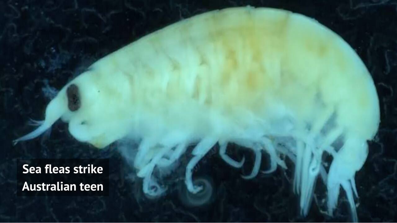 Sea fleas, the mysterious sea creatures that left Australian teenager's ...