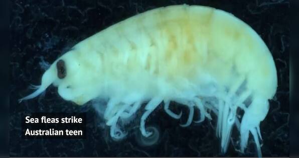 Sea fleas, the mysterious sea creatures that left Australian teenager's ...