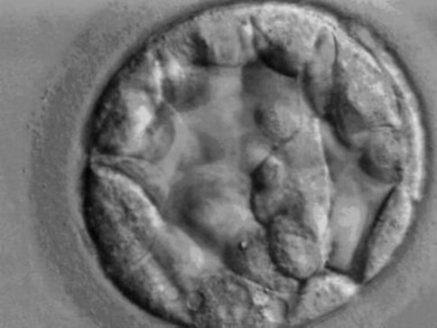 Crispr Gene Editing Technique Sheds Light On Key Gene For Human Embryo