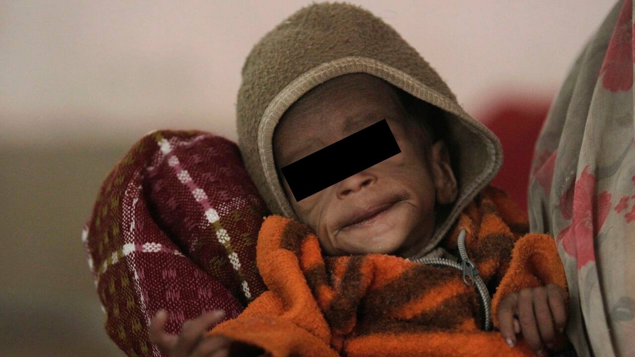 Study links underweight children in urban India with social ...