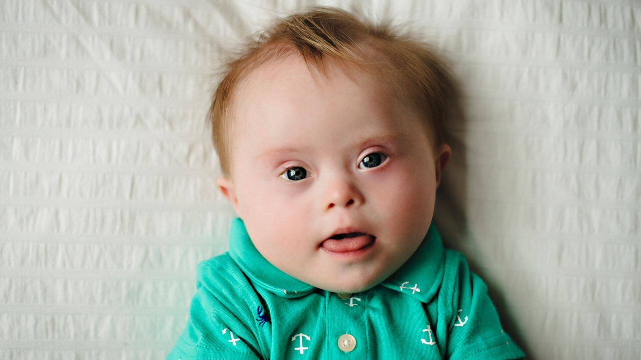 Four In Five Children With Down Syndrome Are Born To Mothers Under The Four In Five Children With Down Syndrome Are Born To Mothers Under The