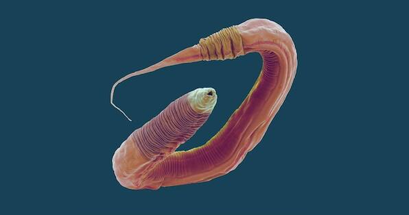 Scientists succeed in mapping every neuron in a worm, a breakthrough in ...