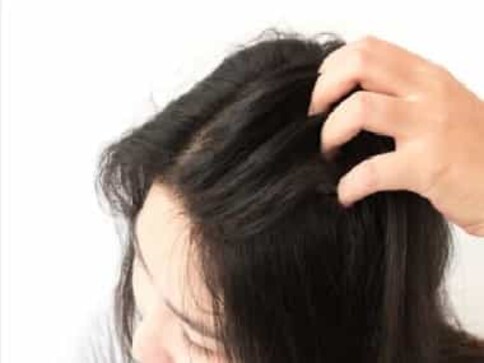 Scalp acne can be painful and irritating: All you need to know about ...