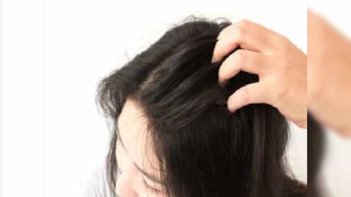 Scalp acne can be painful and irritating: All you need to know about ...
