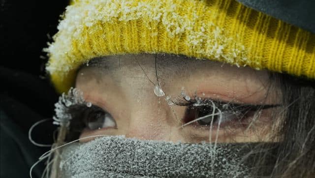 It’s so cold at Beijing Olympic Games that faces have frozen! - Photos ...