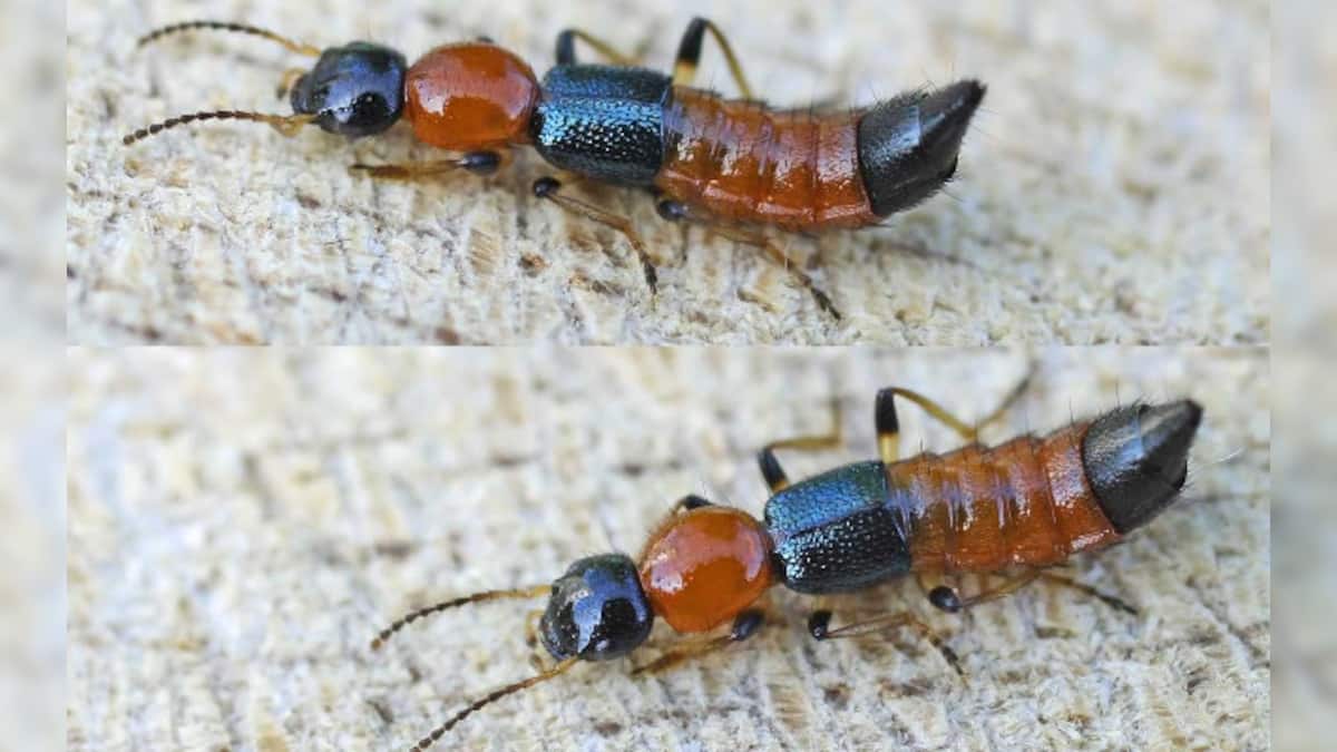 Sikkim students infected by Nairobi flies: What are the skin-burning ...