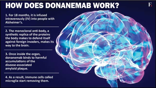 Can new drug donanemab really slow the growth of Alzheimer's disease ...