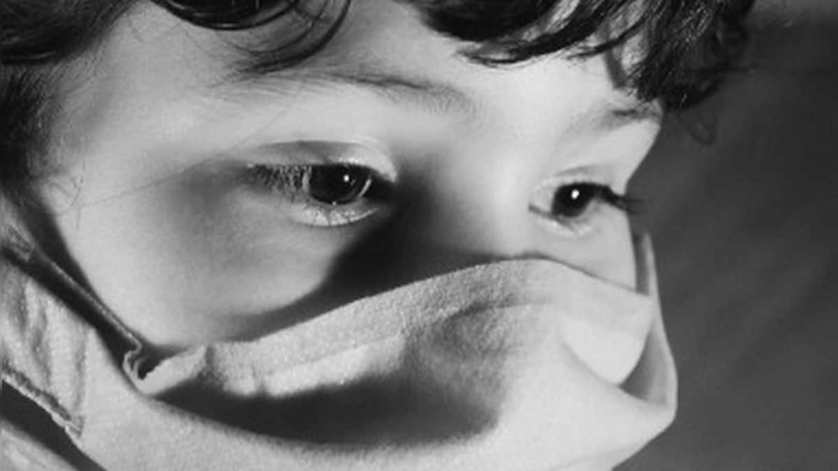 Wearing a face mask for too long can lead to skin breakout: Here's what ...